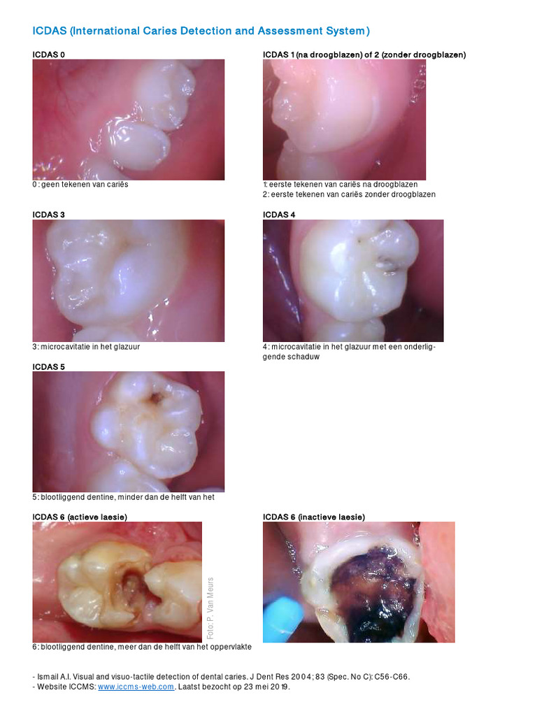 Afbeeldingen Icdas-4 | PDF