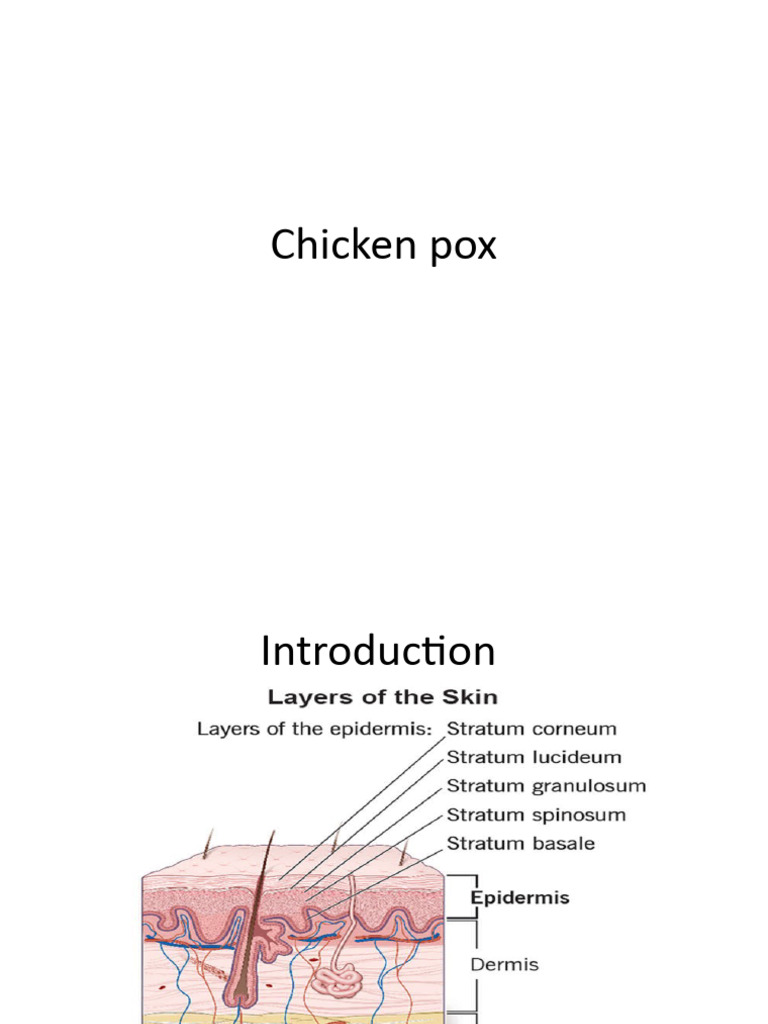 Chicken Pox | PDF