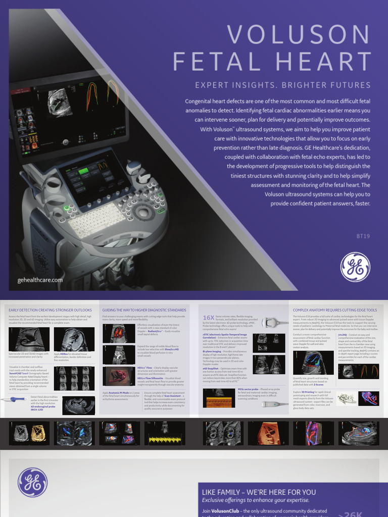 Voluson Fetal Heart Clinical Innovations Voluson Expert bt19 | PDF ...
