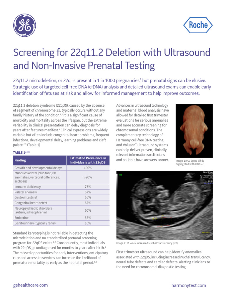 Screening For 22q11 2 Deletion With Ultrasound Non Invasive Prenatal ...