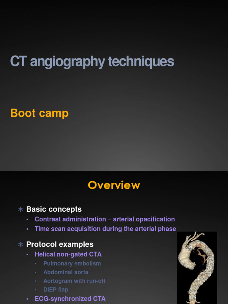 Bài 2. Nguyên Lý CTA | PDF | Ct Scan | Aorta