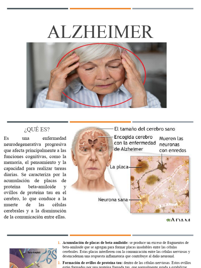 Alzheimer SGB | PDF | Enfermedad de Alzheimer | Beta amiloide