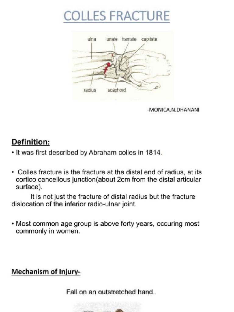 Colles Fracture 67450994 | PDF