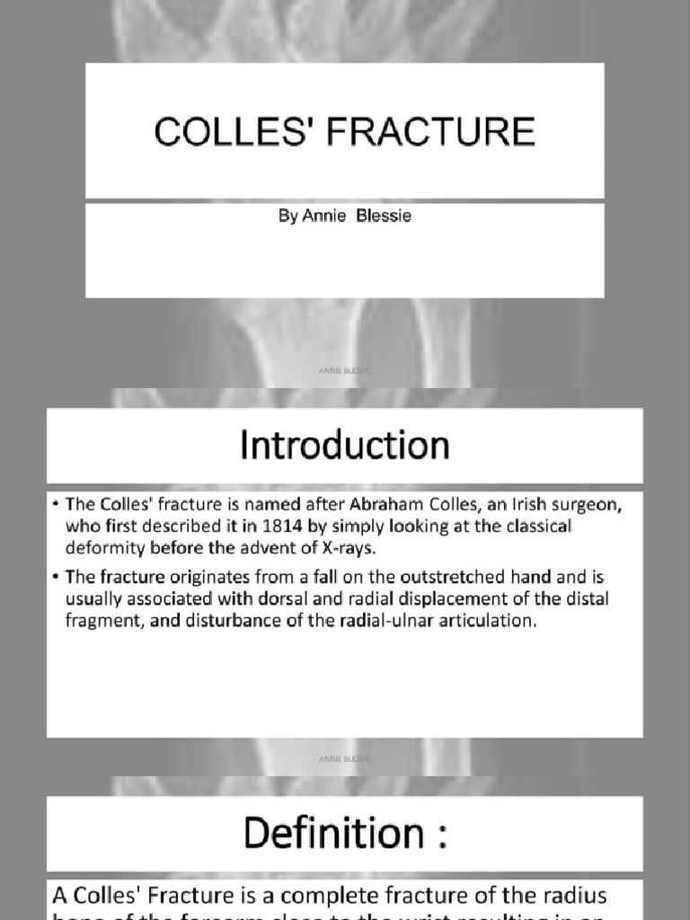 Colles Fracture Physiotherapy Management | PDF