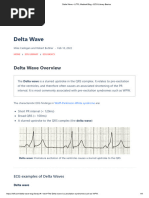 Delta Wave - LITFL Medical Blog - ECG Library Basics | PDF | Medical ...