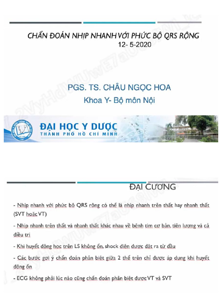 SVT - QRS R NG | PDF