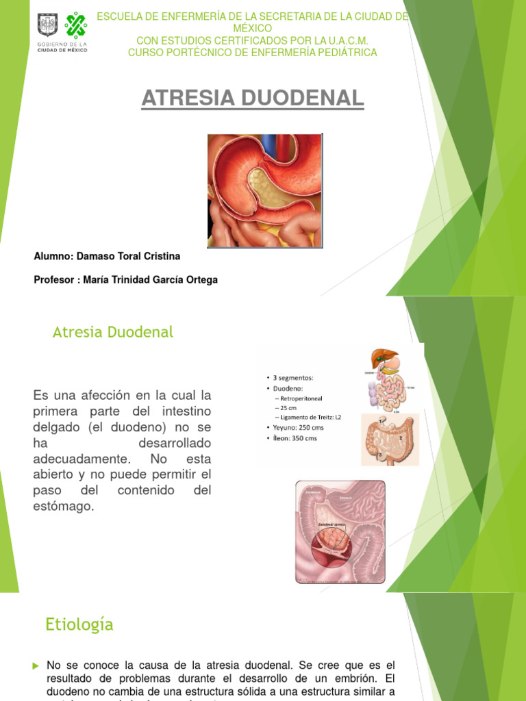 Atresia Duodenal: Diagnóstico y Tratamiento | PDF | Heces | Tracto ...
