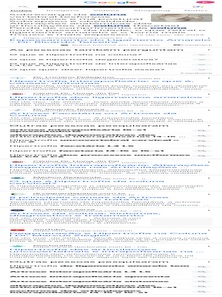 O Que Causa Hipertrofia Coluna - Pesquisa Google | PDF | Osteoartrite | Coluna vertebral