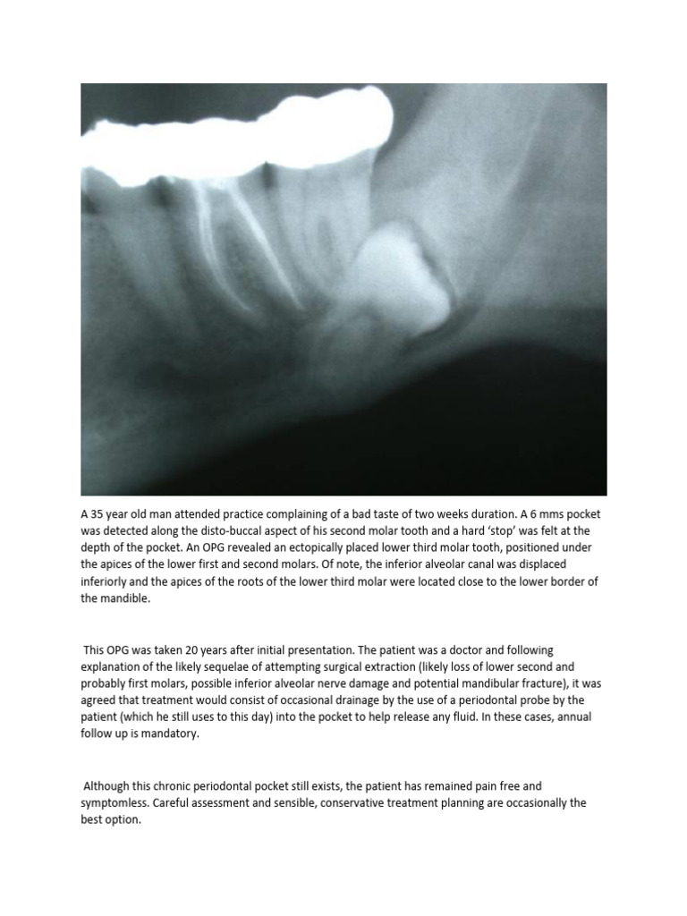 Miscellaneous Cases | PDF | Human Tooth | Clinical Medicine