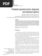 Canine Impaction and Its Management | PDF | Orthodontics | Dental Anatomy