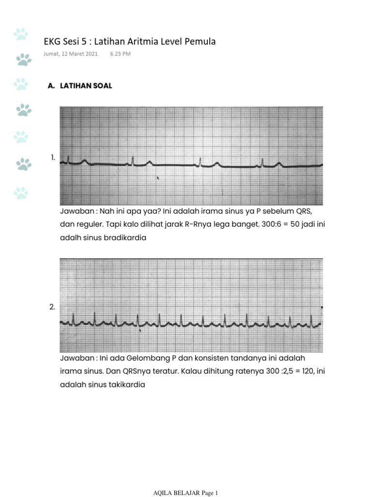 EKG Sesi 5 Latihan Aritmia Level Pemula | PDF