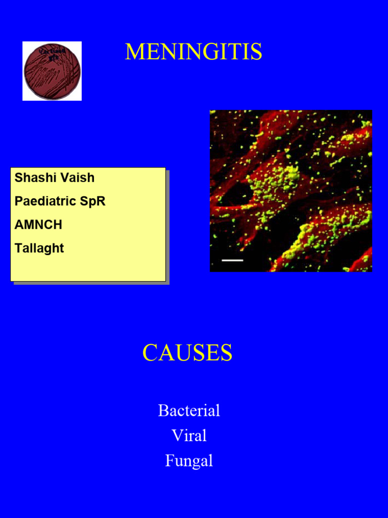 Meningitis | PDF | Meningitis | Medical Specialties