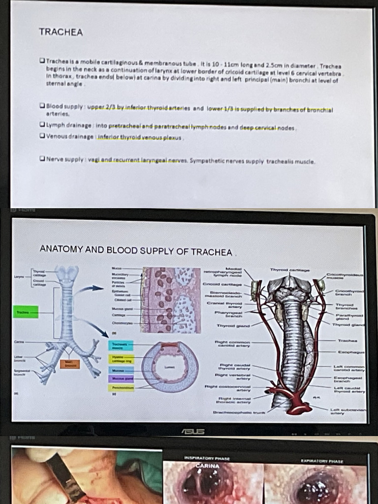 Copy of Lec 1 Ppt Trachea | PDF