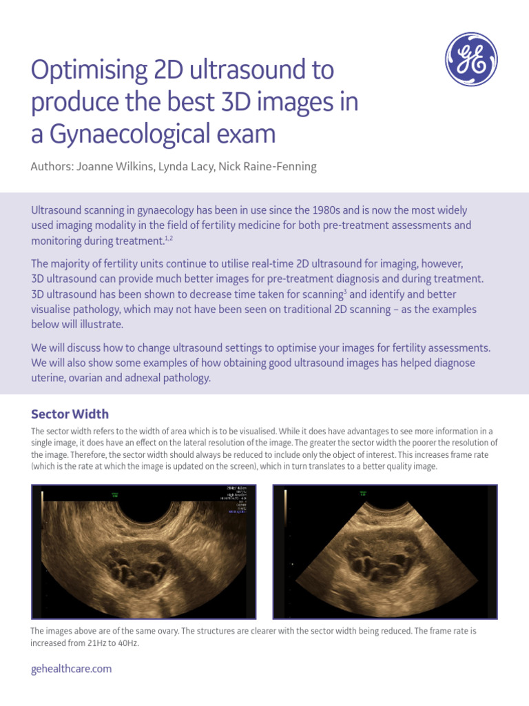Optimising 2D Ultrasound To Produce The Best 3D Images in GYN Exams ...