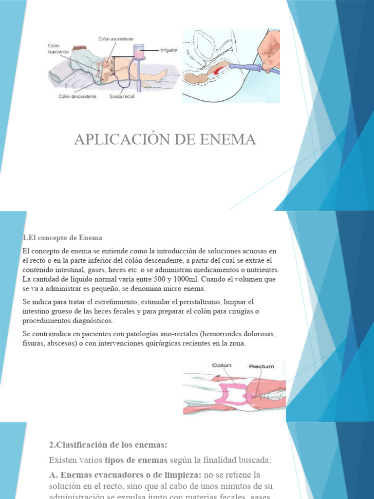 Tipos y Aplicación de Enemas | PDF | Hemorroides | Heces