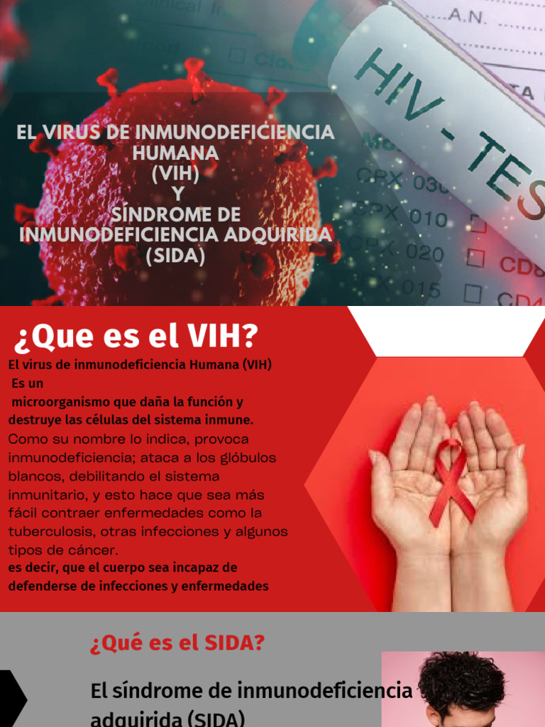 VIH-SIDA y sus generalidades | PDF | VIH / SIDA | VIH