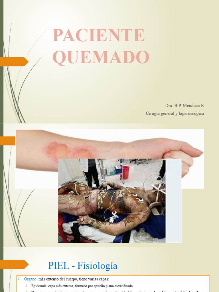 Paciente Quemado | Descargar gratis PDF | Quemar | Especialidades Medicas