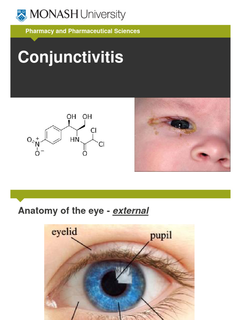 Bacterial Conjunctivitis - 2015 | PDF | Causes Of Death | Medicine
