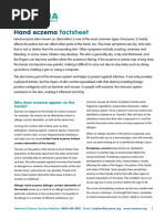 Dyshidrotic Eczema (Pompholyx, Vesicular Hand Eczema) - DermNet | PDF ...