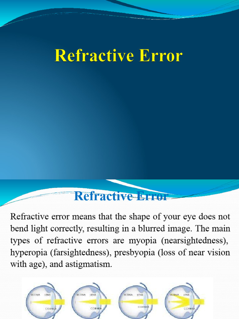 Understanding Refractive Errors in Vision | PDF | Myopia | Human Eye