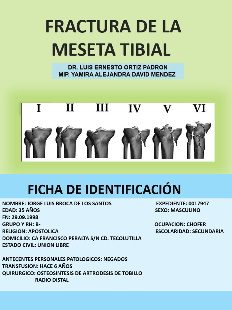 Fractura de La Meseta Tibial Yadm | PDF