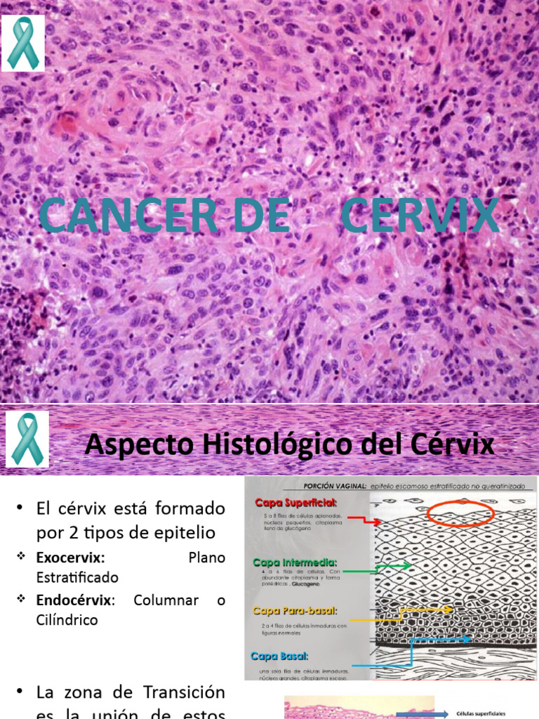 Estructura Y Lesiones Del Cérvix Pdf Cáncer De Cuello Uterino