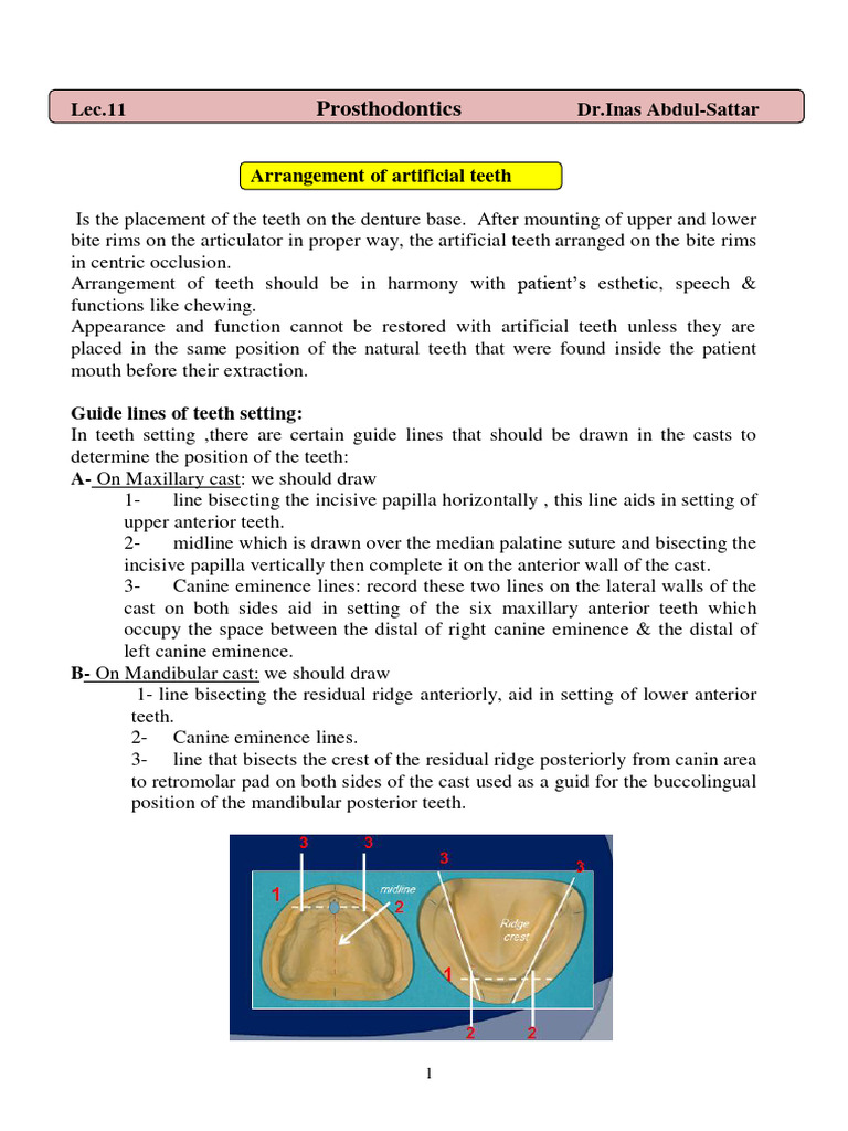 Arrangement of Artificial Teeth Principles | PDF | Mouth | Dentistry