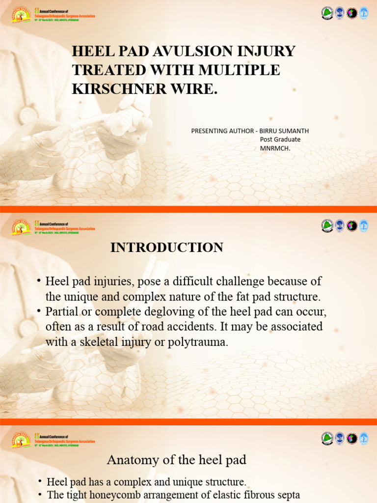 Heel Pad Avulsion: K-Wire Technique | PDF