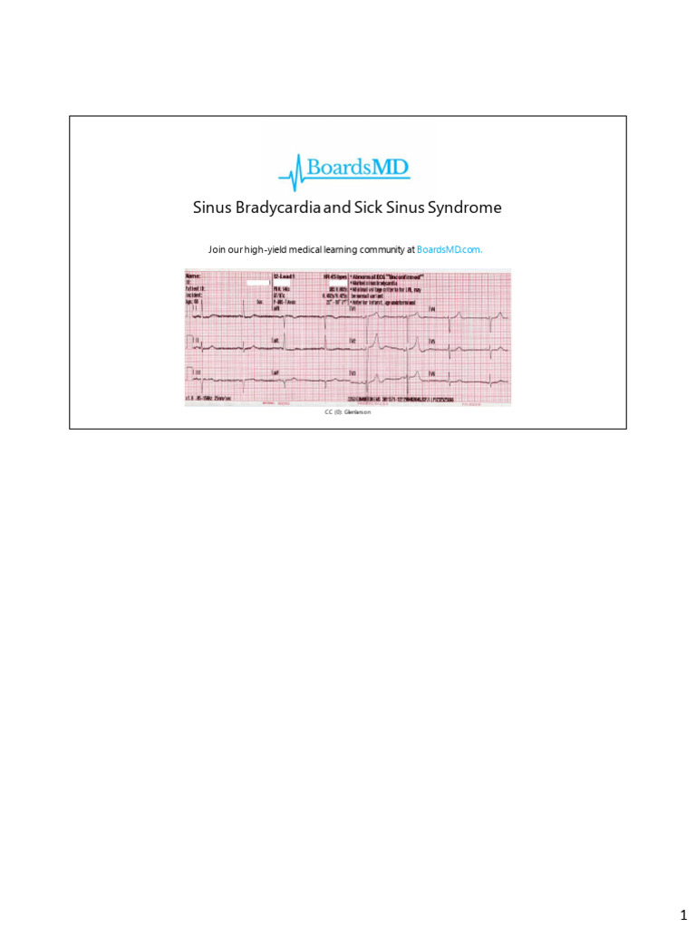 Sinus Bradycardia and Sick Sinus Syndrome | PDF | Cardiovascular ...