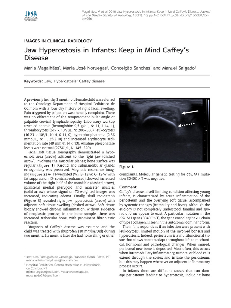 Caffey's Disease | PDF | Neoplasms | Bone