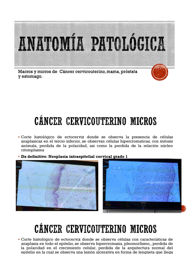 Macros y Micros | PDF | Cáncer de mama | Estómago