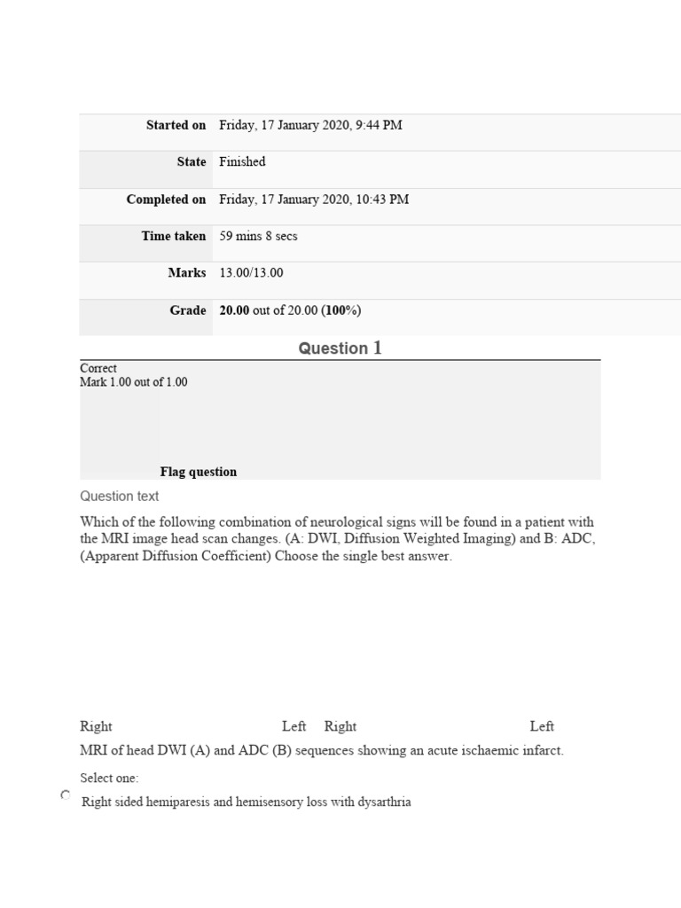 t32 Stroke | PDF | Stroke | Angiology