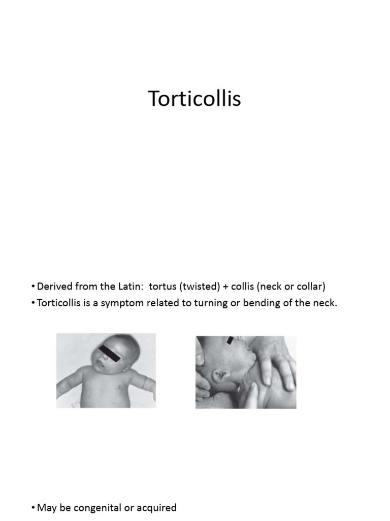 Torticollis Pdf Diseases And Disorders Clinical Medicine