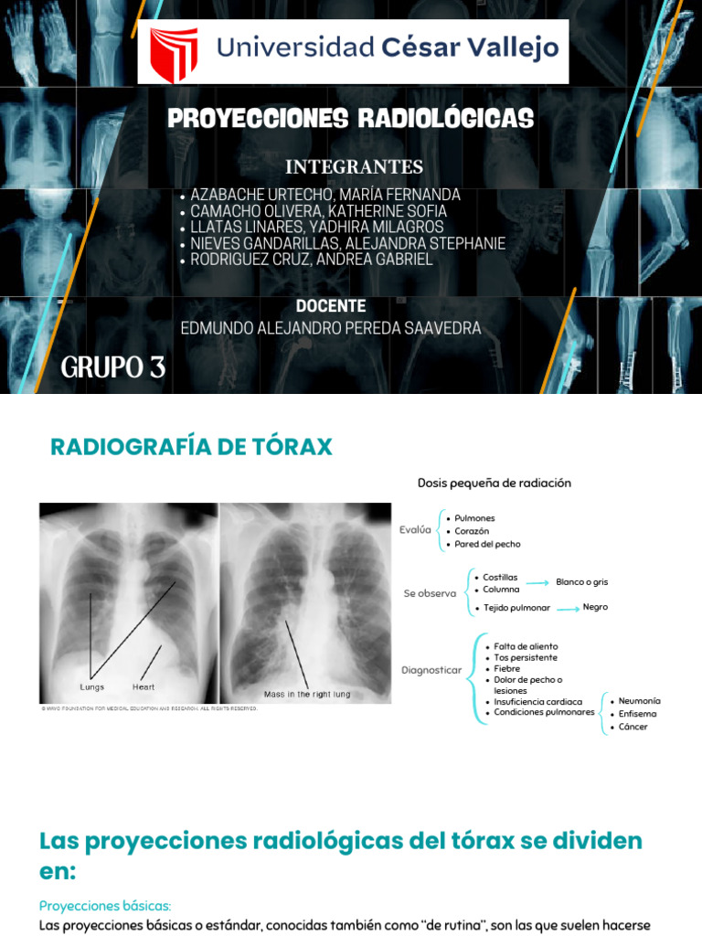 IMAGEN - Proyecciones Radiológicas | PDF | Hombro | Tórax