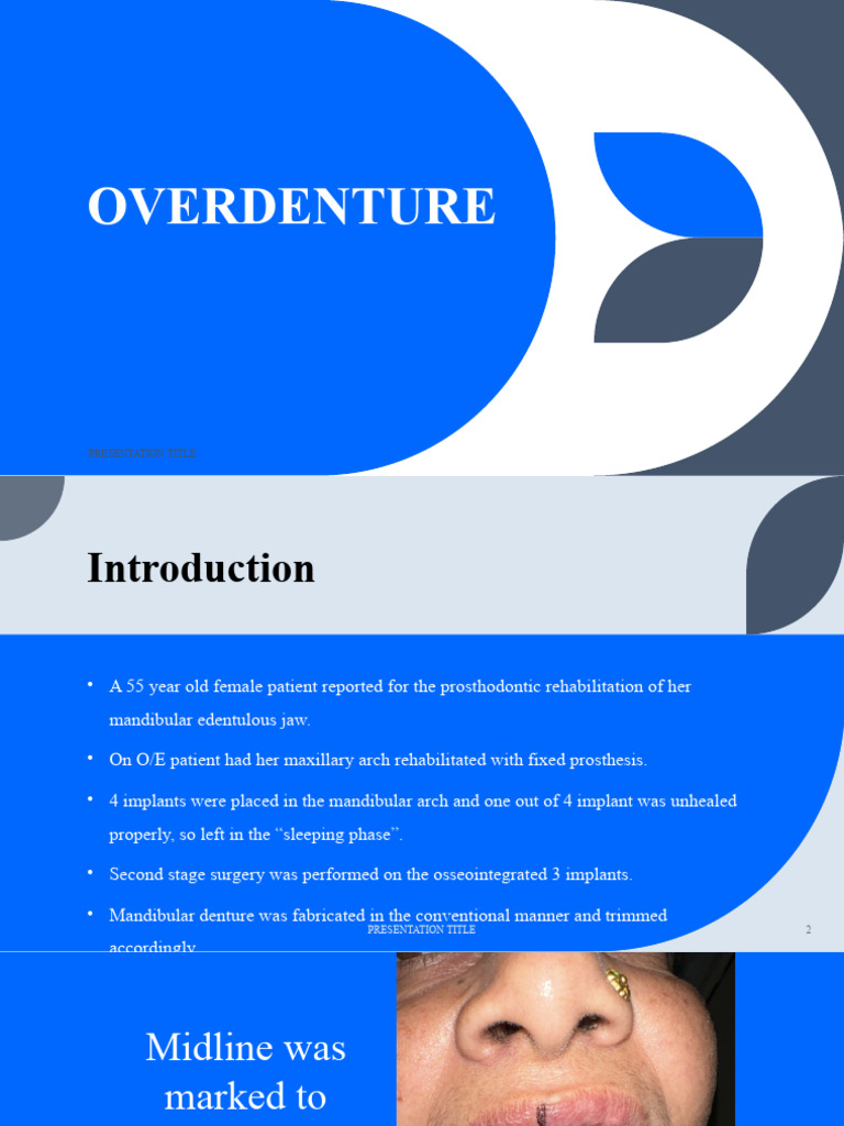 Overdenture Case | PDF