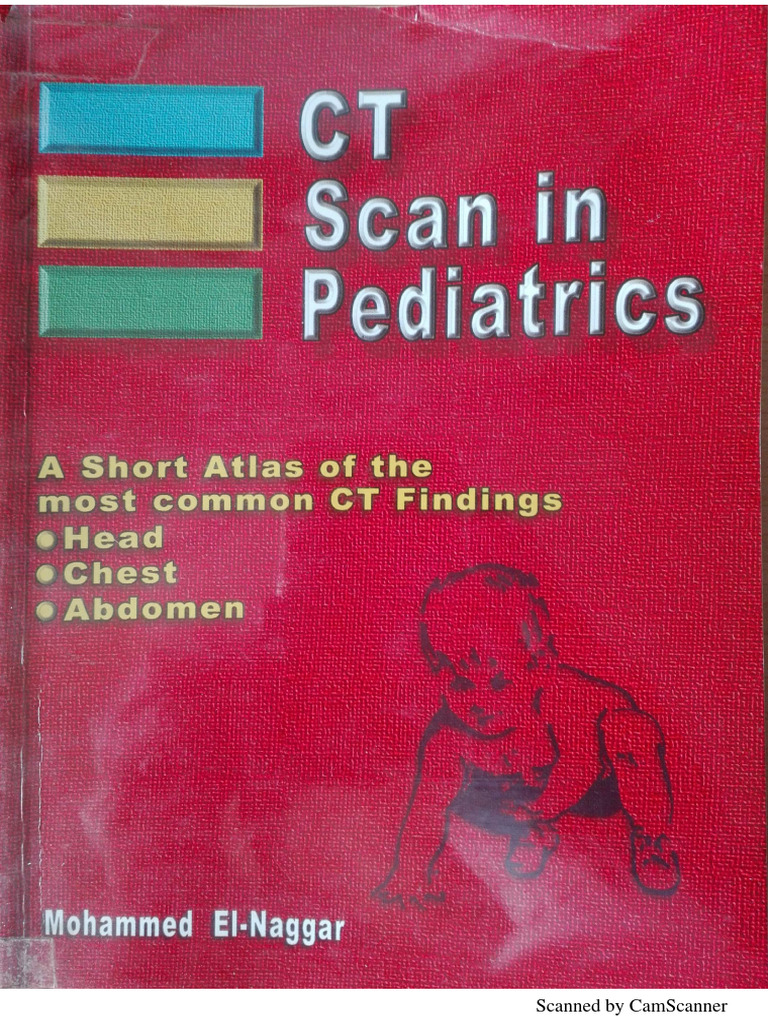 9) - CT Scan in Pediatrics | PDF