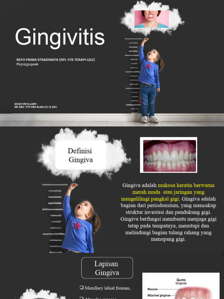 Modul Gingivitis | PDF