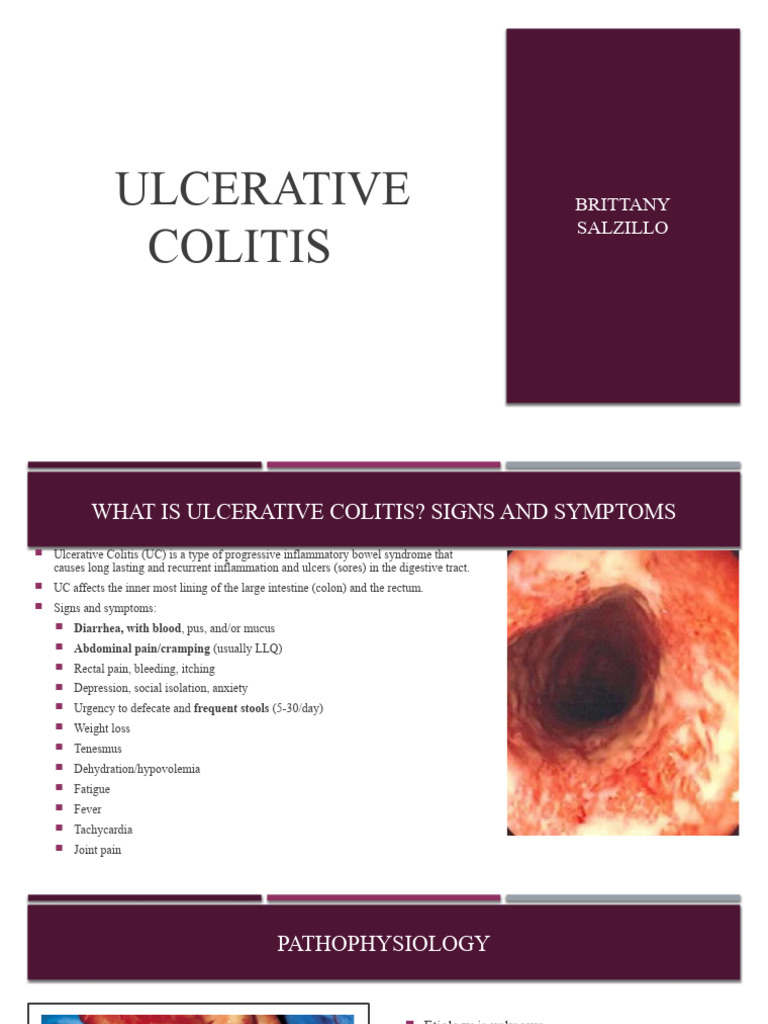 EBP | PDF | Ulcerative Colitis | Causes Of Death