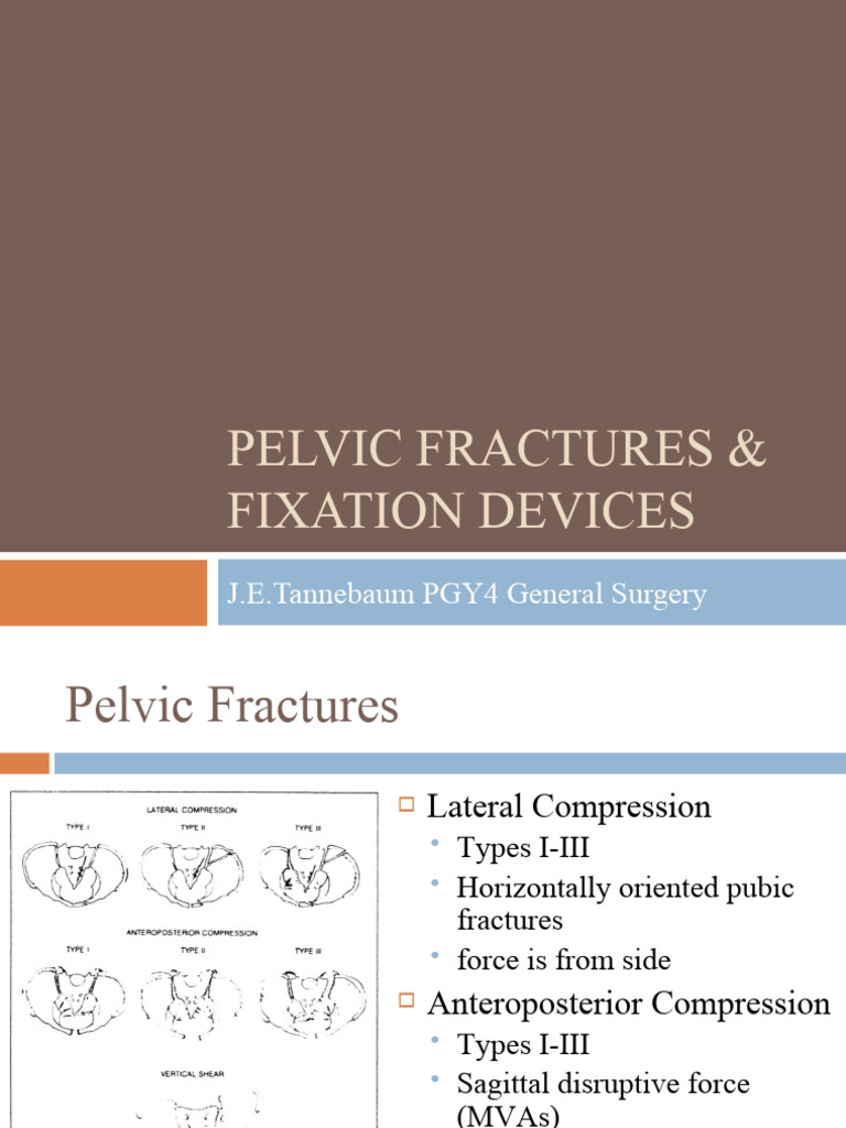 Pelvic Fractures | PDF | Pelvis | Traumatology