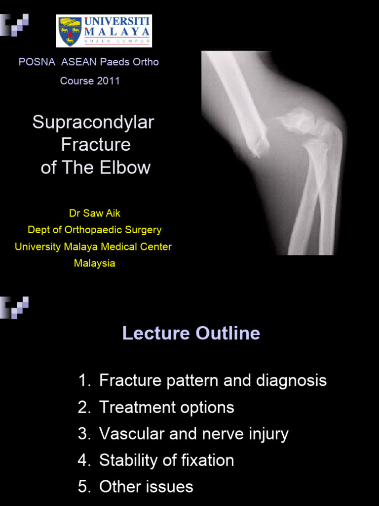 Supracondylar Fracture of The Elbow - Saw Aik | PDF | Skeletal System ...