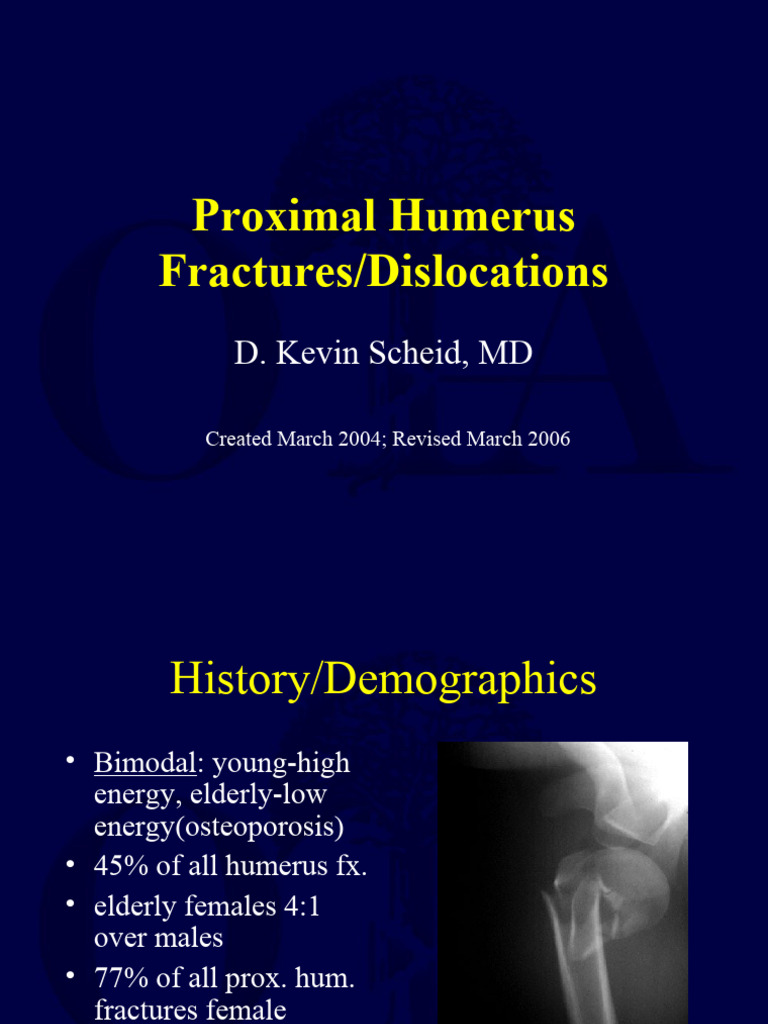 Prox Humerus SHLDR Dis | PDF | Musculoskeletal System | Joints