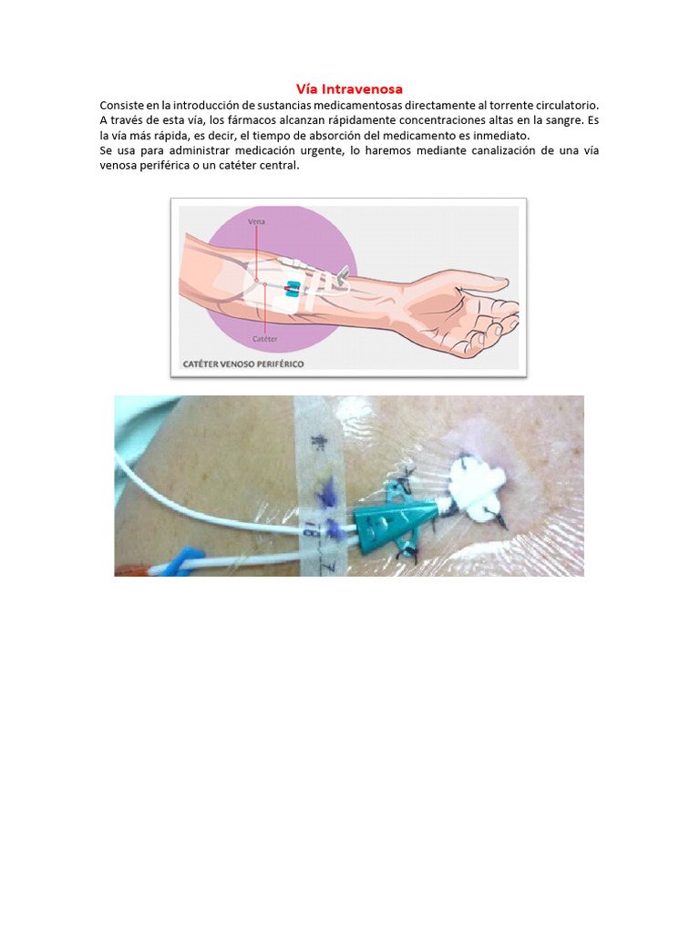 Administración de Medicamentos Intravenosos | PDF | Terapia intravenosa ...