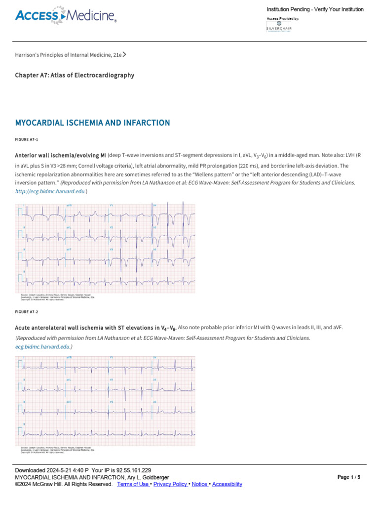 Myocardial Ischemia and Infarction | PDF | Electrocardiography | Cardiology