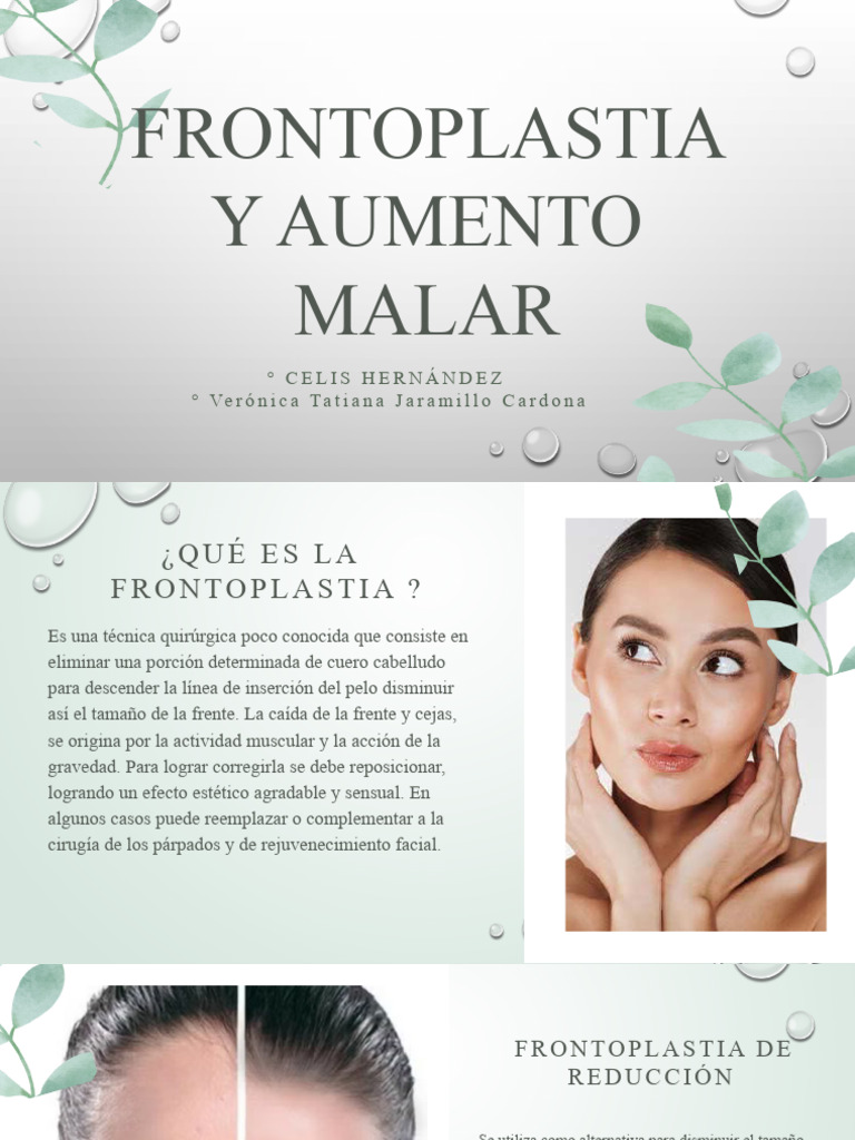 Frontoplastia: Guía Completa y Cuidados | PDF | Cirugía | Endoscopia