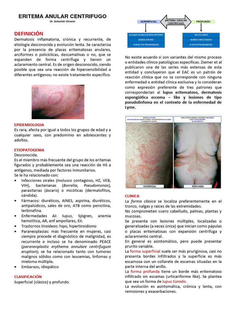 Eritema Anular Centrífugo | Descargar gratis PDF | Ciencias de la Salud | Dermatología