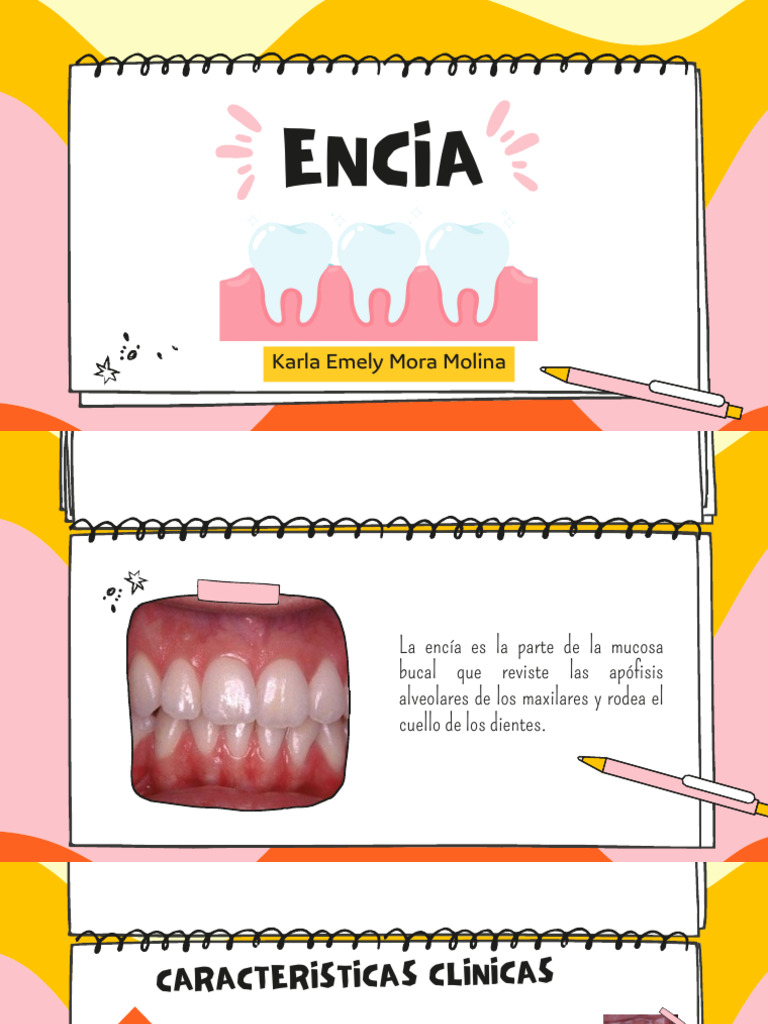 Estructura y Función de la Encía Gingival | PDF | Epitelio | Anatomia ...