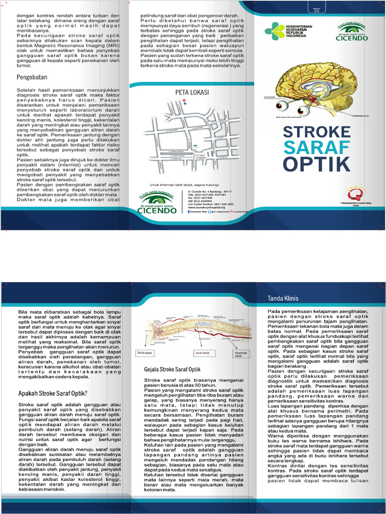 15 Stroke Saraf Optik | PDF