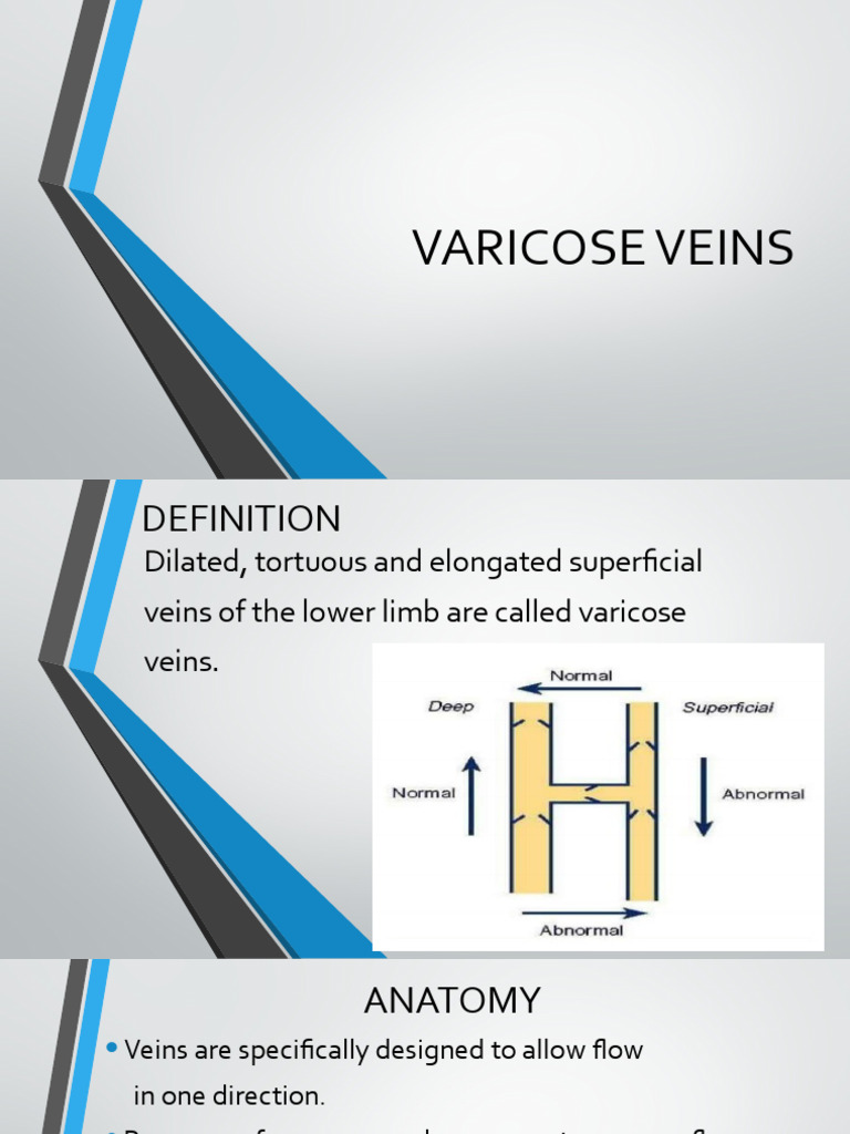 Varicose Veins | Download Free PDF | Vein | Varicose Veins