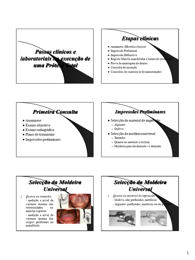 Passos para Prótese Total: Guia Completo | PDF