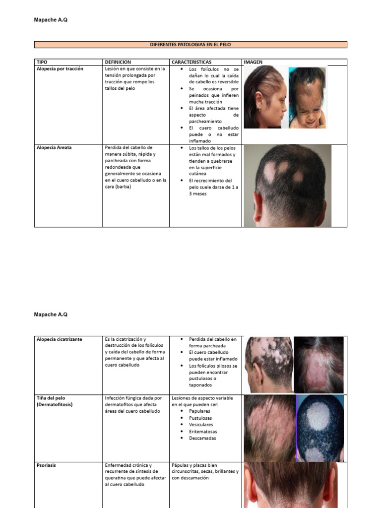 Patologías del cabello y alopecia | PDF | Perdida de cabello | Cabeza y ...
